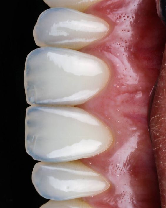 ENCERADO Y FESTONEADO ANATÓMICO | Genially