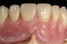 ENCERADO Y FESTONEADO ANATÓMICO | Genially