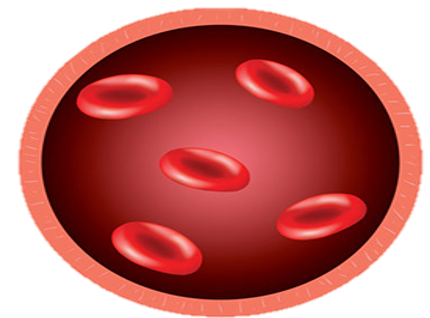 Anemia infantil | Genially